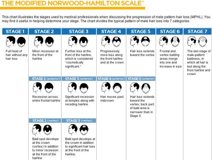 norwood-hamilton-scale – Aderans Hair Centre